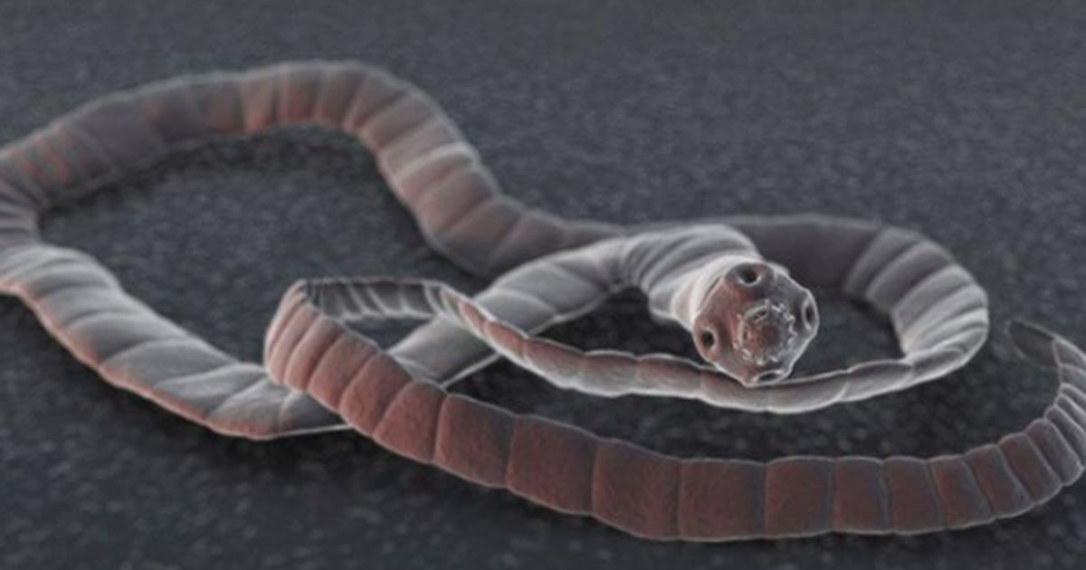 Diese Parasiten sind perfekt an den Menschen angepasst